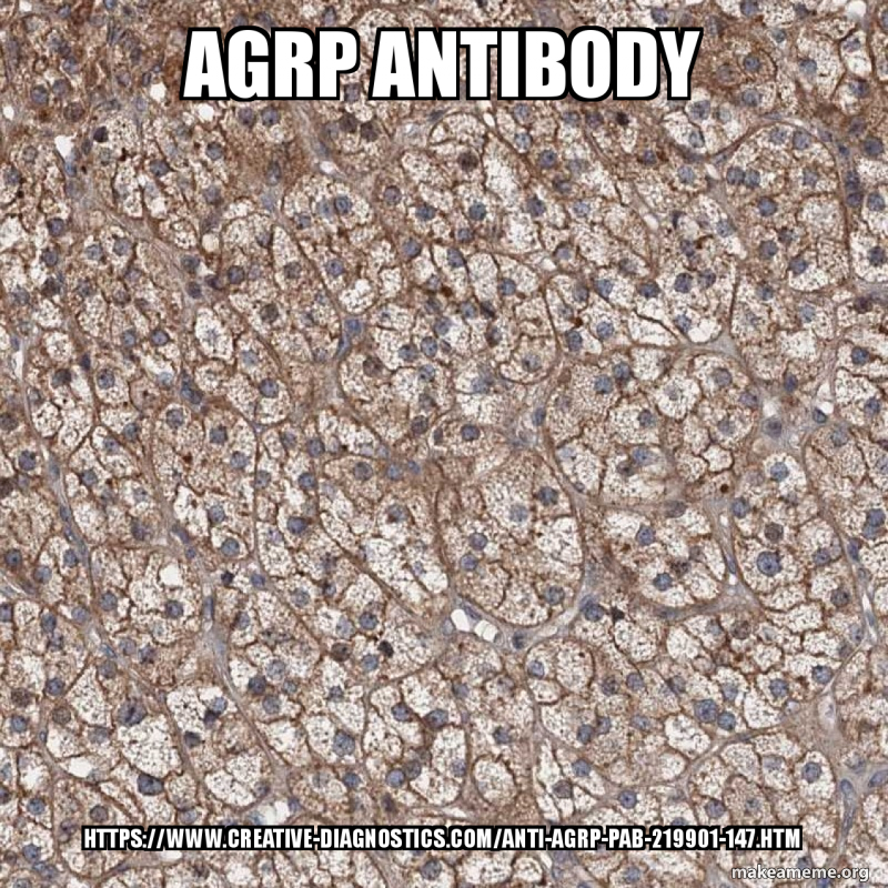 agrp antibody https://www.creative-diagnostics.com/Anti-AGRP-PAb-219901 ...