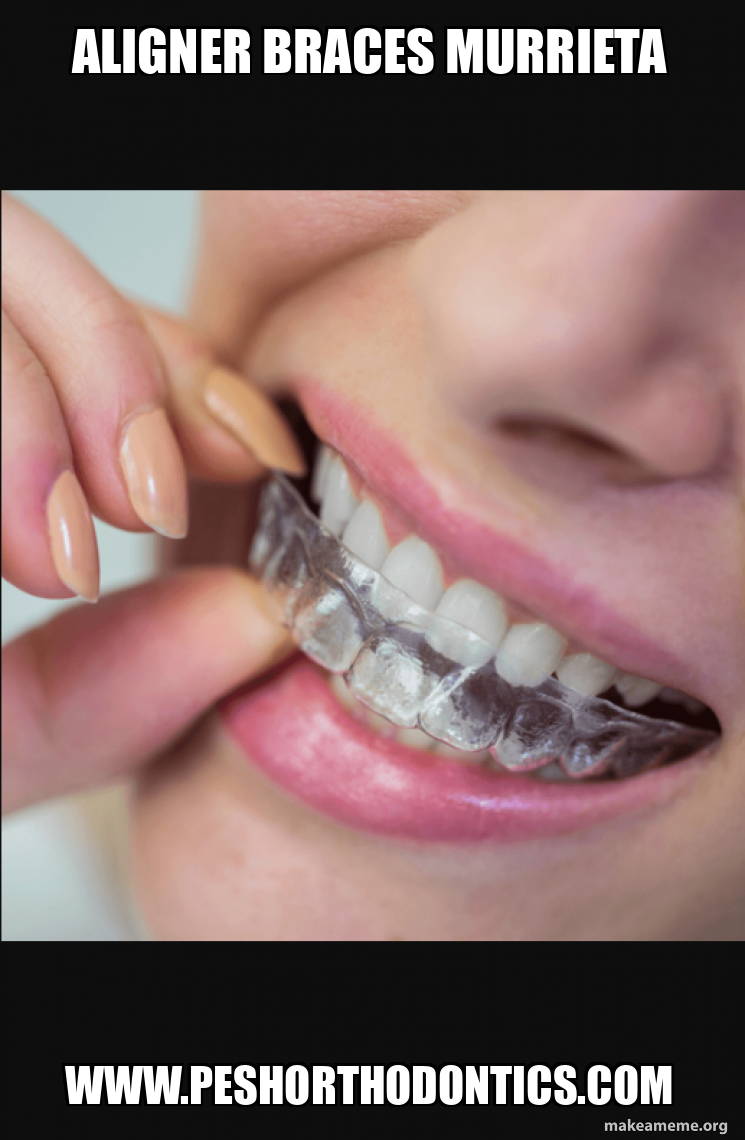 ALIGNER BRACES MURRIETA WWW.PESHORTHODONTICS.COM - ALIGNER BRACES MURRIETA Meme Generator