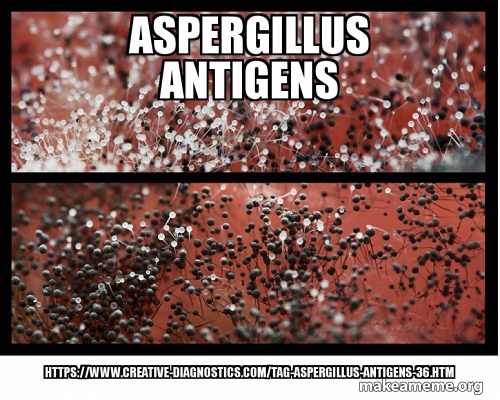 Aspergillus Antigens https://www.creative-diagnostics.com/tag ...