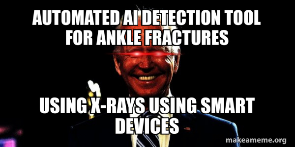 Automated ai detection tool for ankle fractures Using x-Rays using ...