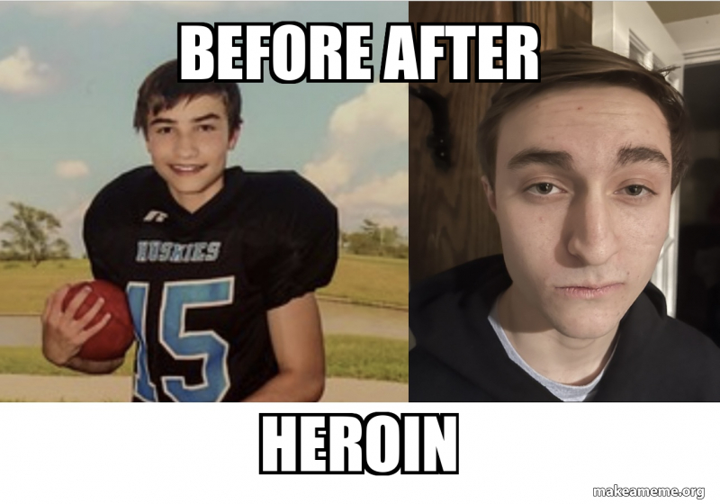Before After Heroin Meme Generator