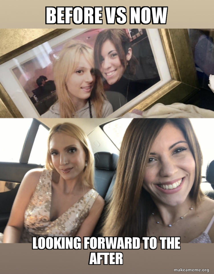 Before vs now Looking forward to the after Meme Generator