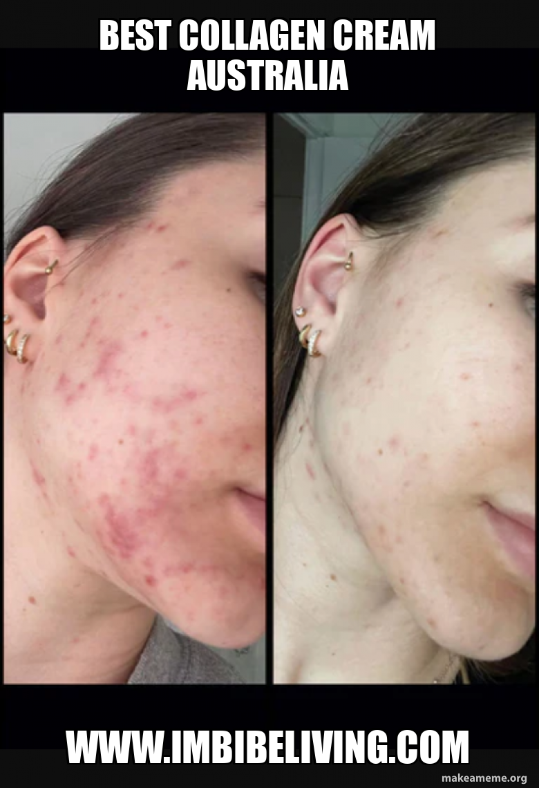 BEST COLLAGEN CREAM AUSTRALIA WWW.IMBIBELIVING.COM - BEST COLLAGEN ...