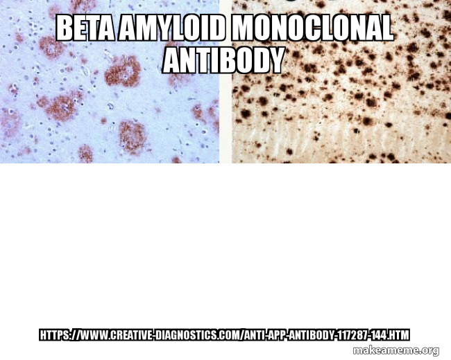 beta amyloid monoclonal antibody https://www.creative-diagnostics.com ...