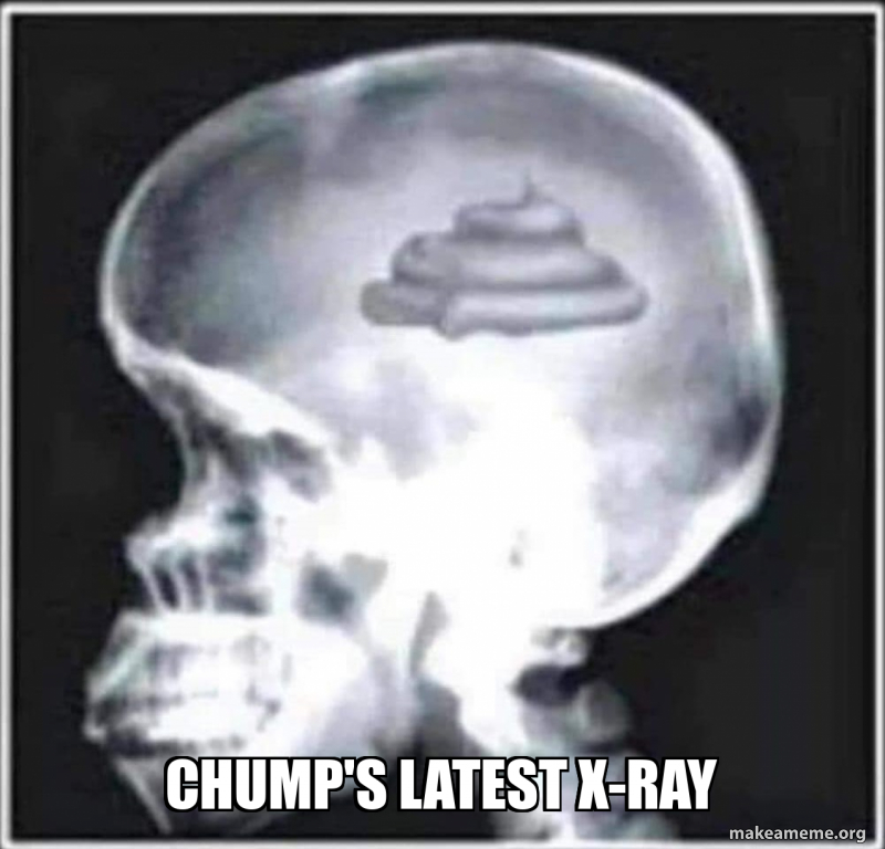 chump's latest x-ray Meme Generator