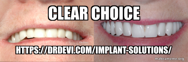 Clear Choice https://drdevi.com/implant-solutions/ Meme Generator
