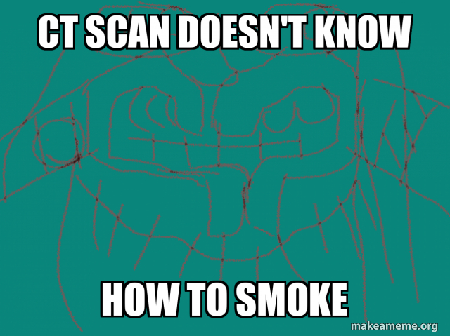 Ct scan doesn't know How to smoke Meme Generator