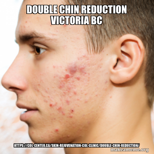 Double Chin Reduction Victoria BC https://col-center.ca/skin ...