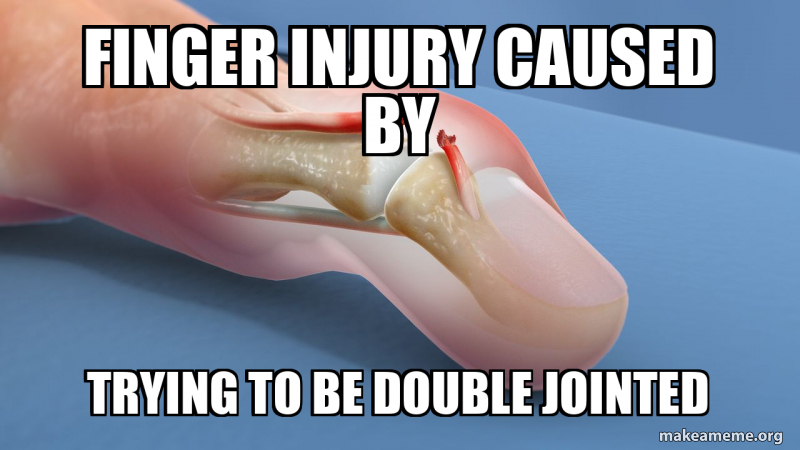 FInger injury caused by trying to be double jointed Meme Generator