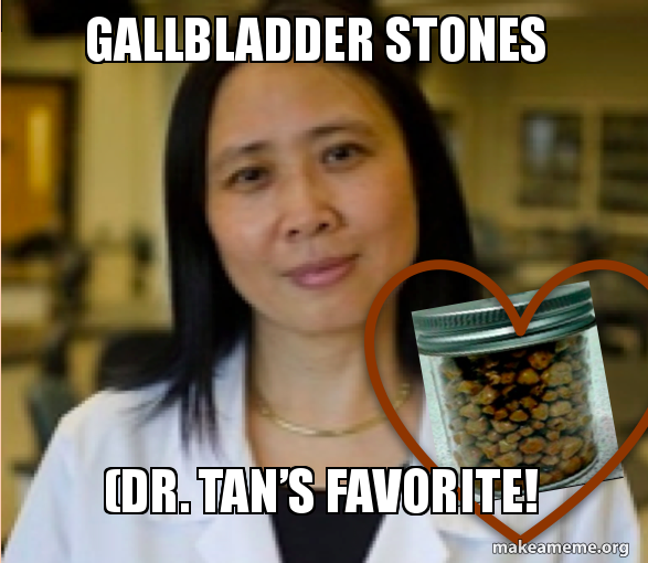 Gallbladder Stones (Dr. Tanâ€™s favorite! | Make a Meme