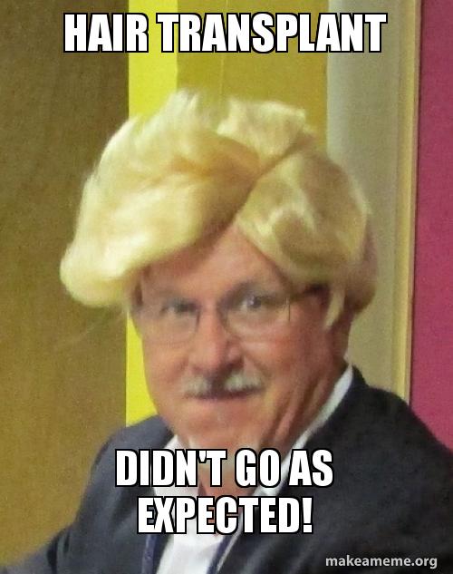 Hair Transplant Didn't Go As Expected! Meme Generator