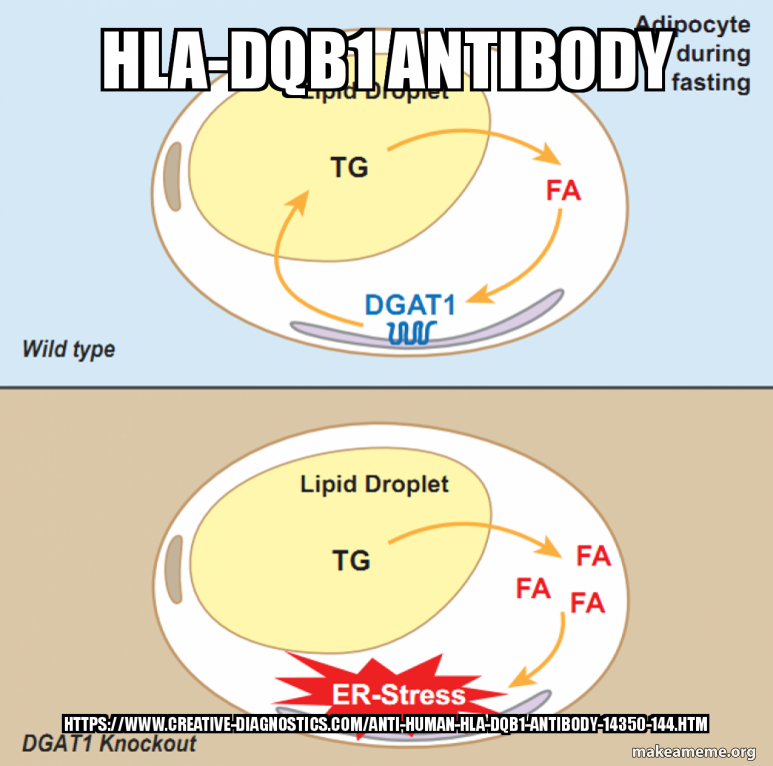 HLA-DQB1 Antibody https://www.creative-diagnostics.com/Anti-Human-HLA ...