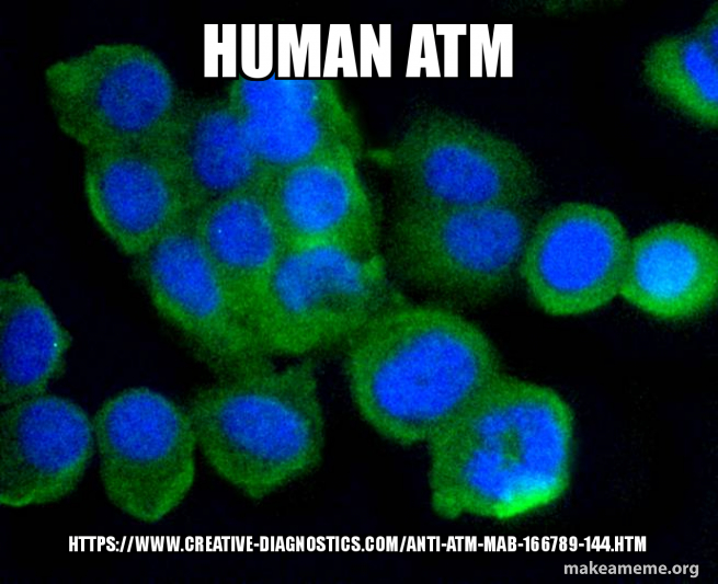 human atm https://www.creative-diagnostics.com/Anti-ATM-MAb-166789-144 ...