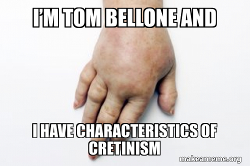 I’m tom Bellone and I have CHARACTERISTICS of cretinism Meme Generator