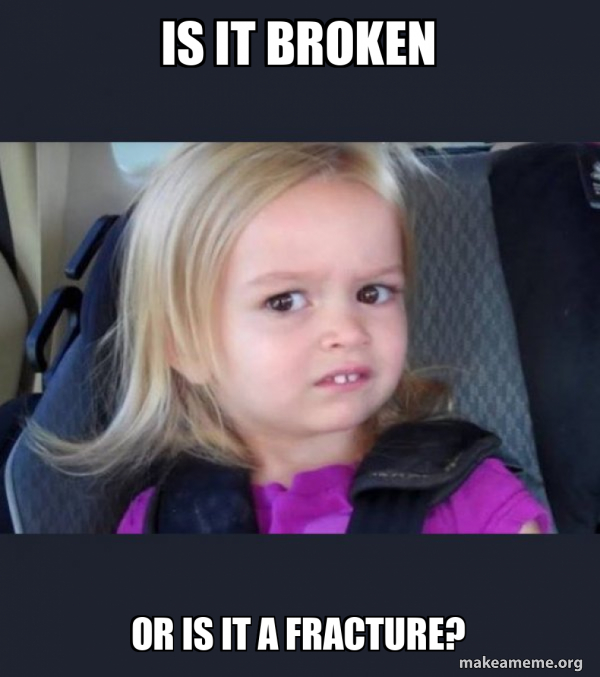 Is it broken or is it a fracture? - Side-Eyes Chloe Meme Generator
