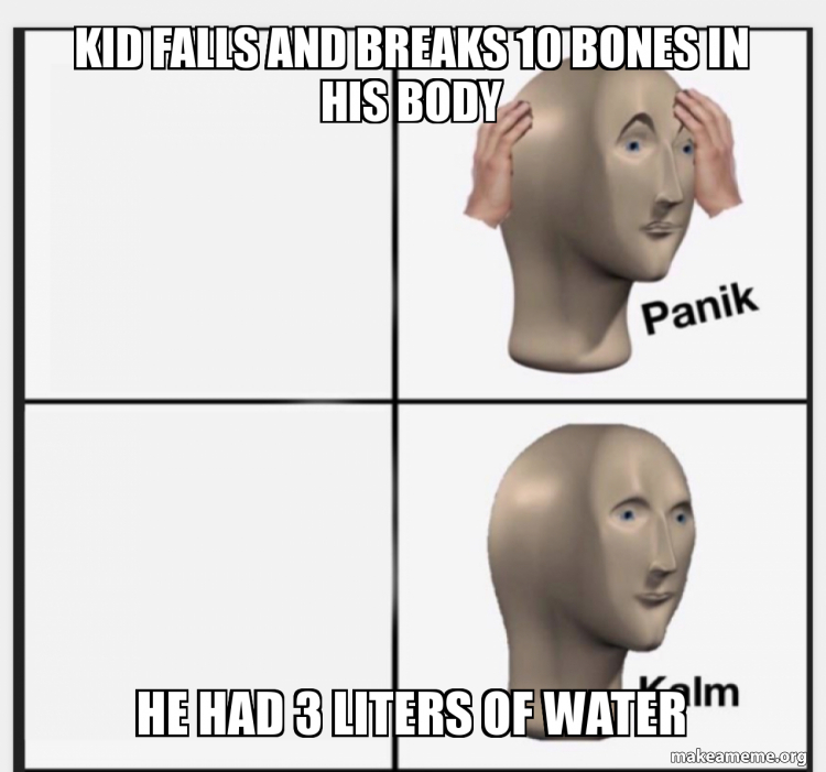 Kid falls and brEaks 10 bones in his body He had 3 liters of water Meme ...