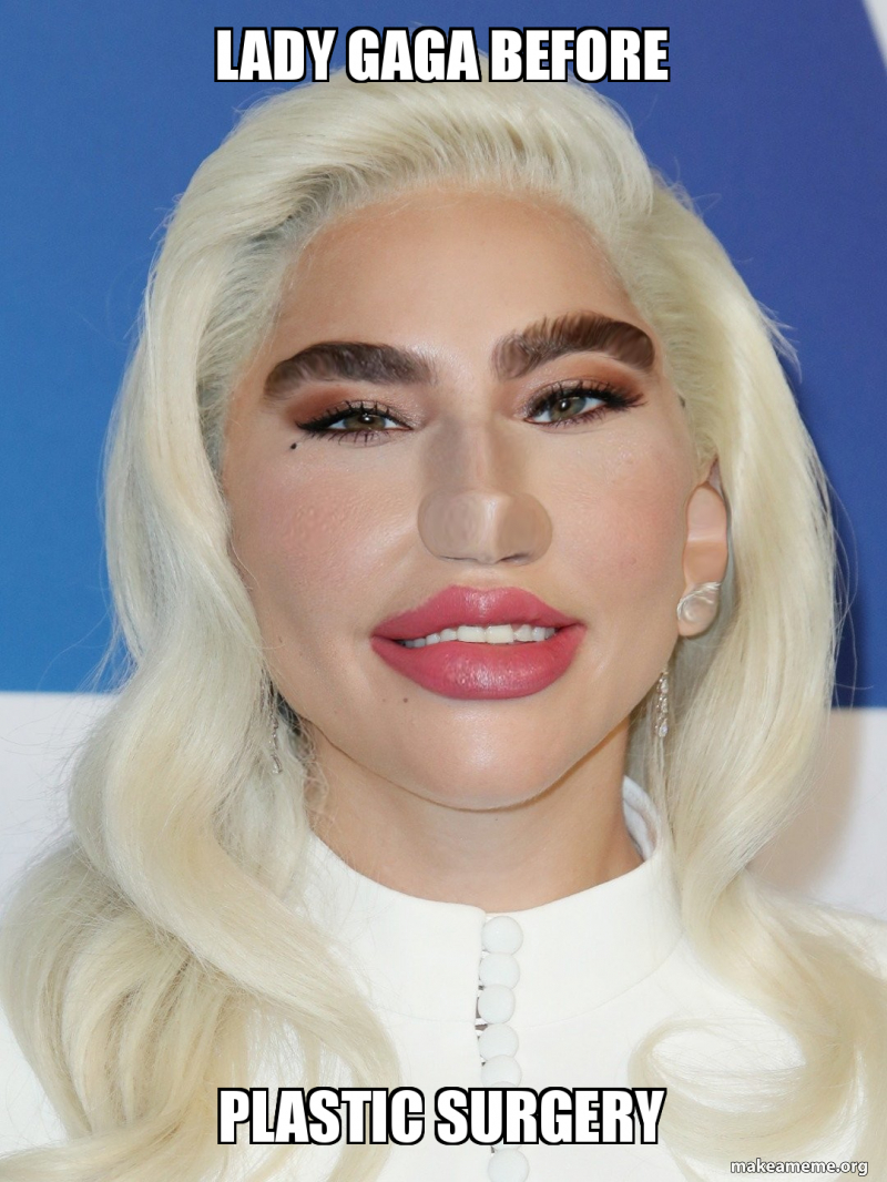 lady gaga before plastic surgery Meme Generator