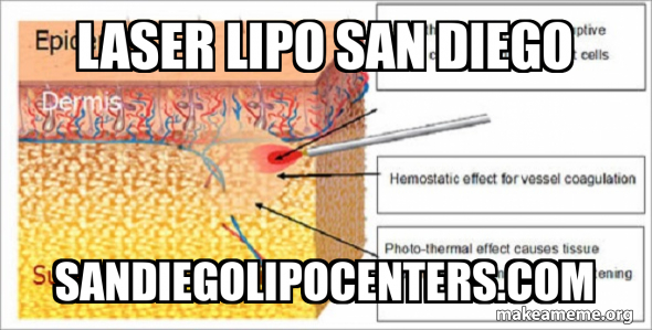 Laser lipo San Diego sandiegolipocenters.com Meme Generator