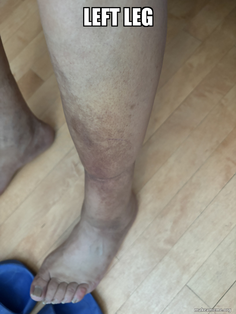 left leg Meme Generator