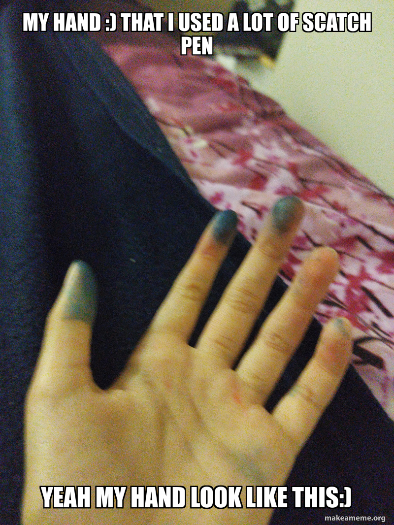 My hand :) that I used a lot of scatch pen Yeah my hand look like this ...