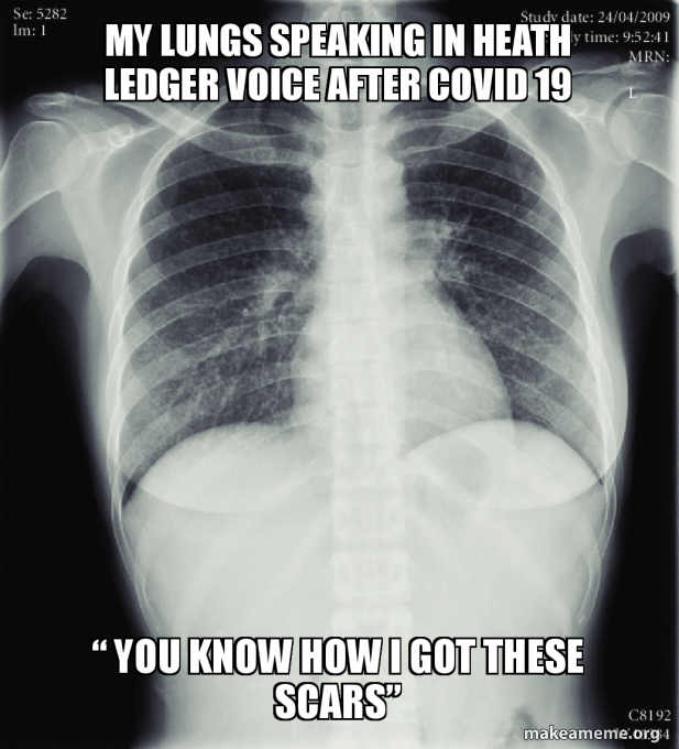 My lungs Speaking in heath ledger voice after covid 19 â€œ you know how ...