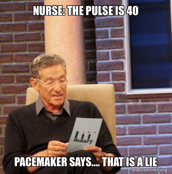 Nurse: The pulse is 40 Pacemaker says.... that is a lie - Maury Povich ...