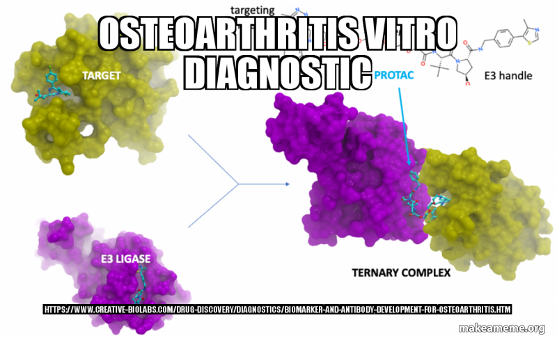 Osteoarthritis vitro diagnostic https://www.creative-biolabs.com/drug ...