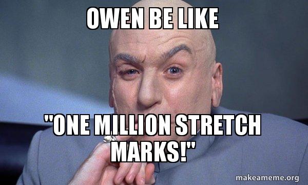 Stretch Mark Memes Stretch Marks Stretch Marks Everywhere Woody And