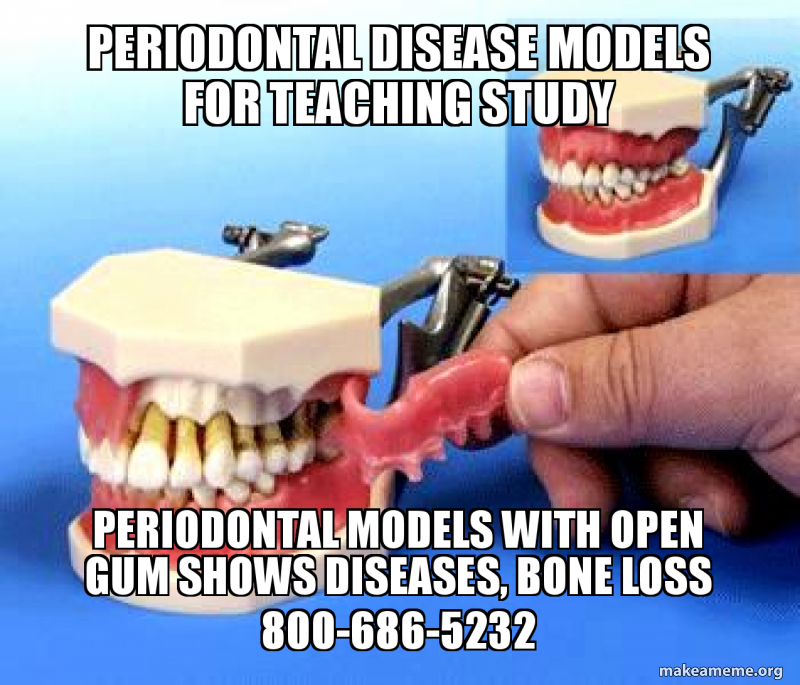 Periodontal Disease Memes
