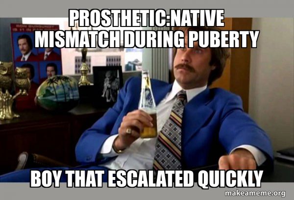 Prosthetic:native Mismatch During Puberty boy that escalated quickly ...