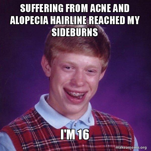 Bad Hairlines Memes Dragon Ball: 10 Hilarious Vegeta Memes That Are