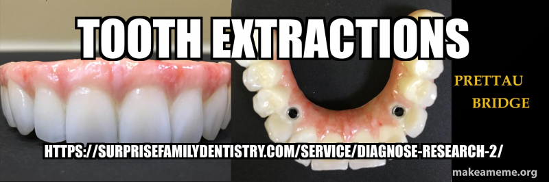 Tooth Extractions https://surprisefamilydentistry.com/service/diagnose ...