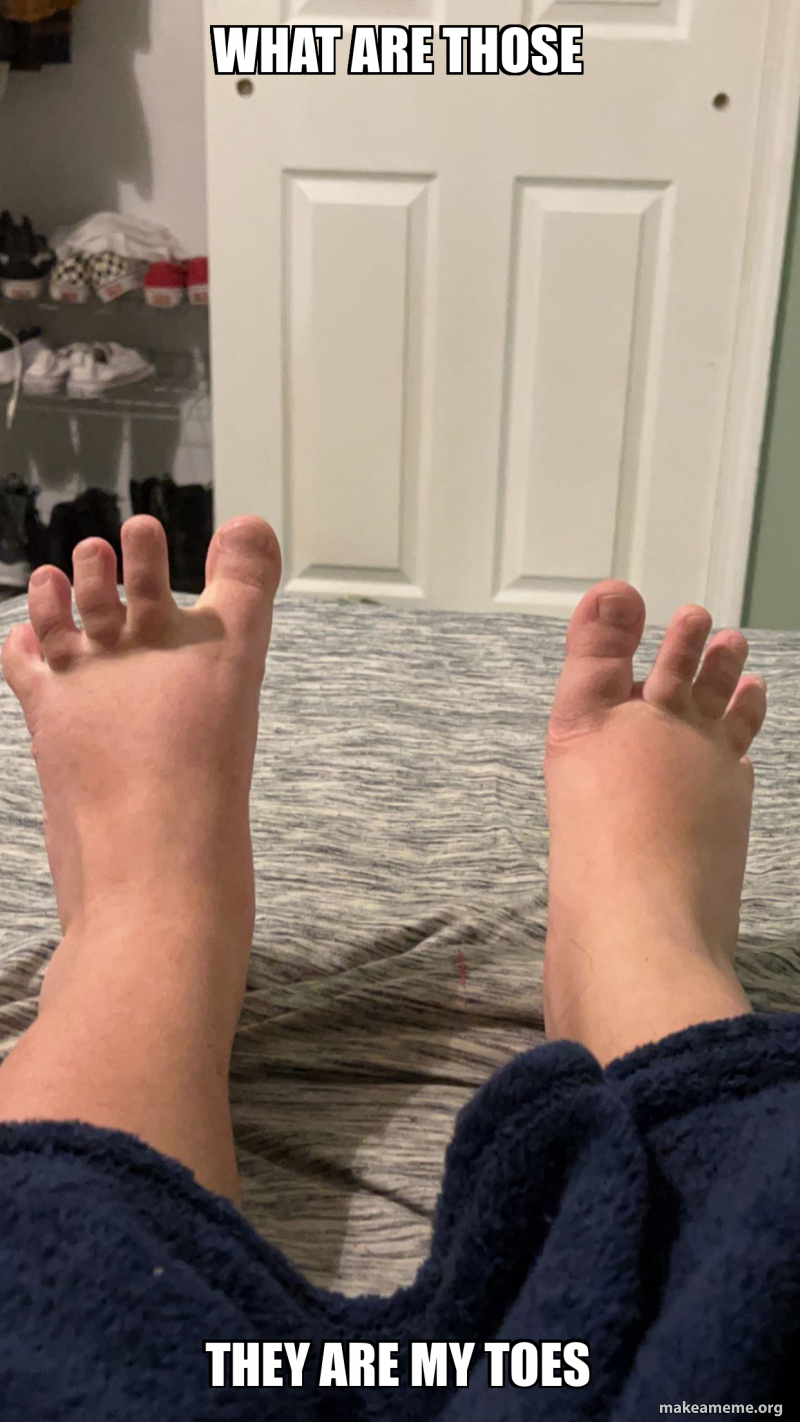 WHAT ARE THOSE THEY ARE MY TOES Meme Generator