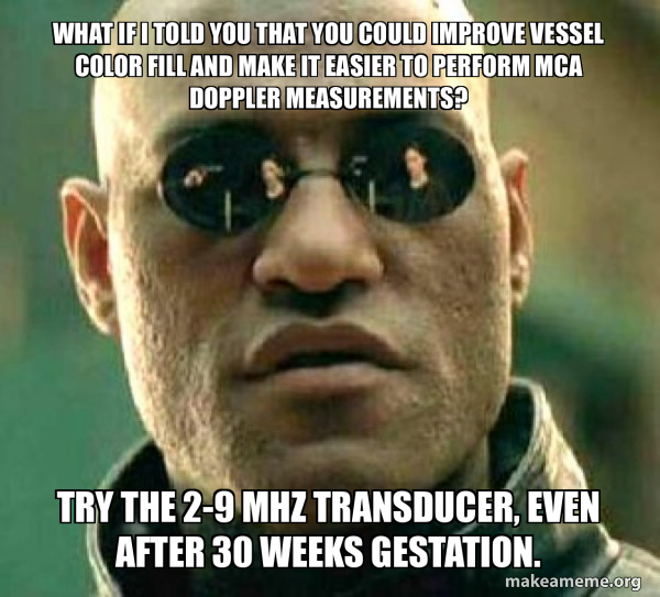 What if I told you that you could improve vessel color fill and make it ...