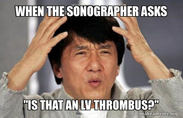 Sonographer Memes World's Best Sonographer Mug Funny Sonographer