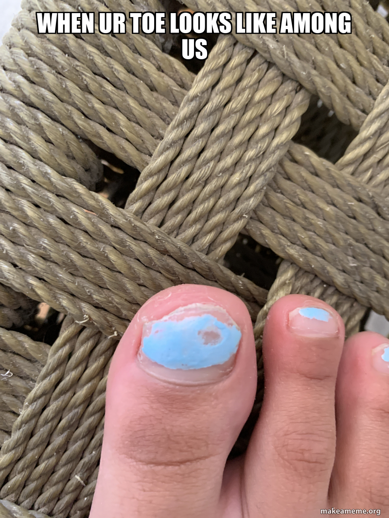 When ur toe looks like among us Meme Generator
