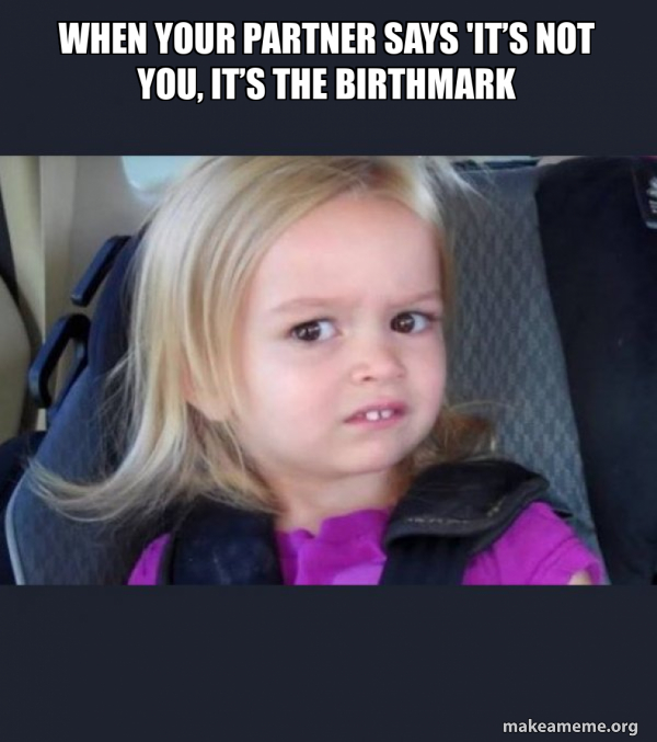 When your partner says 'It’s not you, it’s the birthmark - Side-Eyes ...