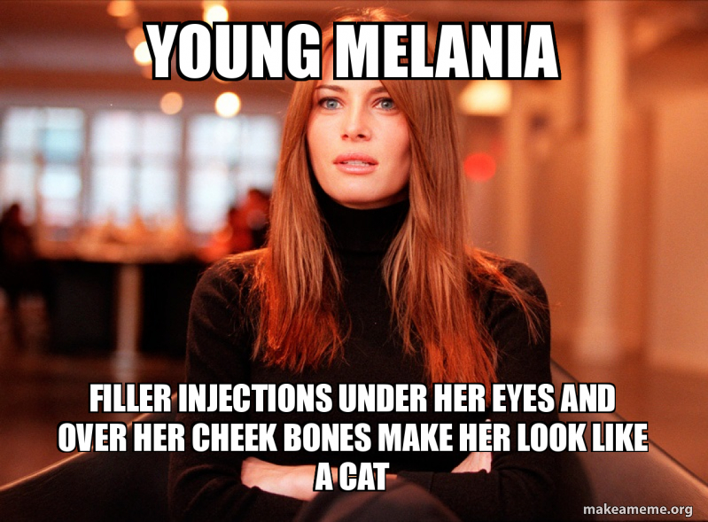 young melania filler injections under her eyes and over her cheek bones ...